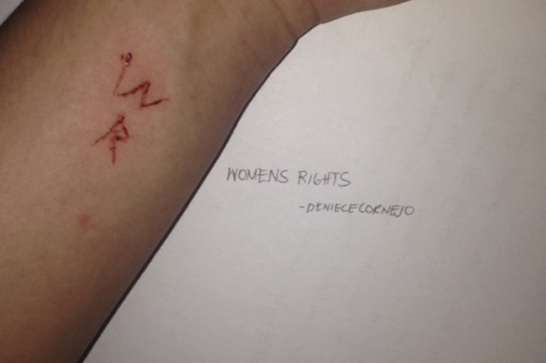 LOOK: Deniece Cornejo’s wrist