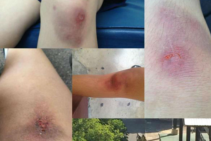 Bangkok school makes late students rub their knees on concrete